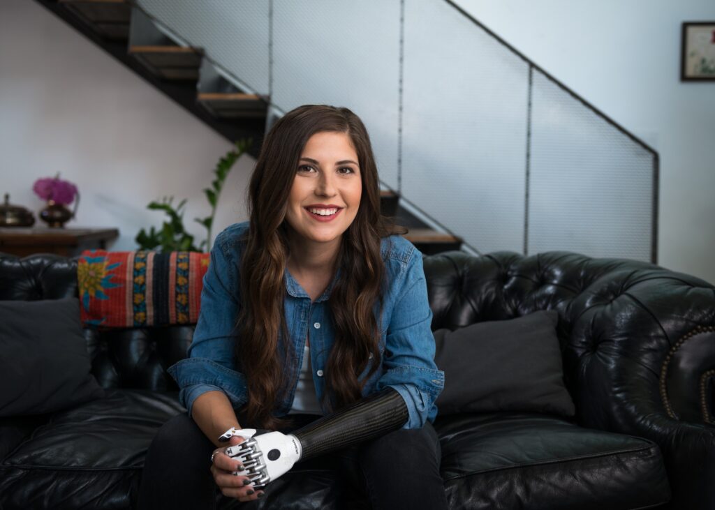 Prosthetic Services - Pelican Orthotics & Prosthetics